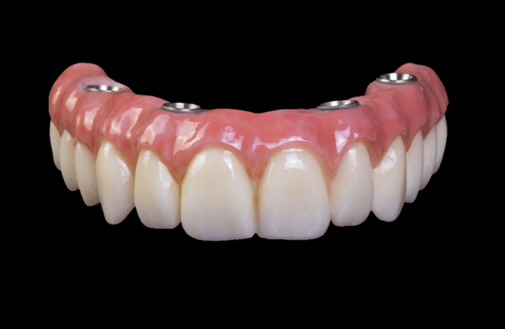 Dental Implants San Antonio TX | DentRight Dental San Antonio